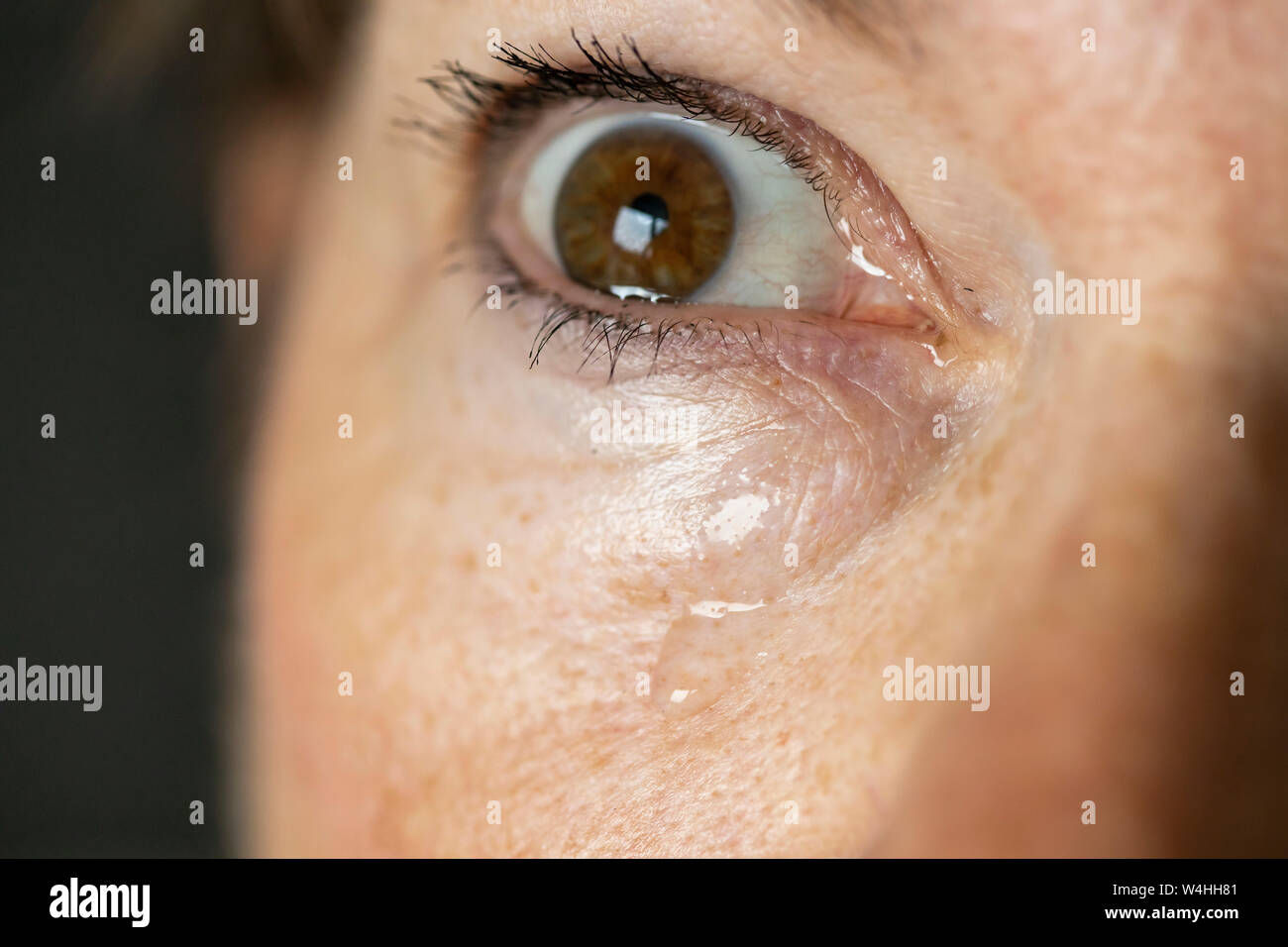 Eye, tears, watery eye Stock Photo - Alamy