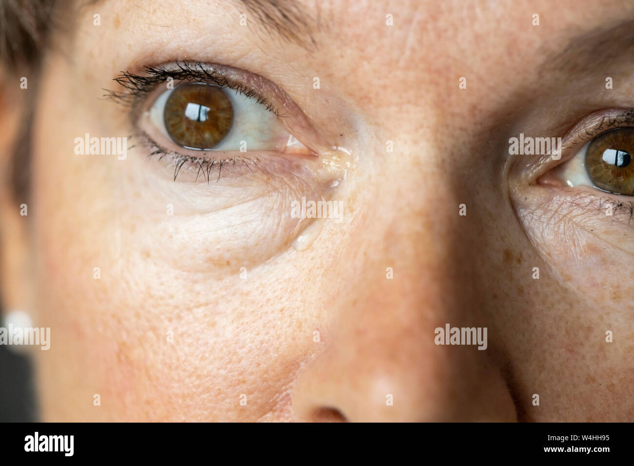 Eye, tears, watery eye Stock Photo - Alamy
