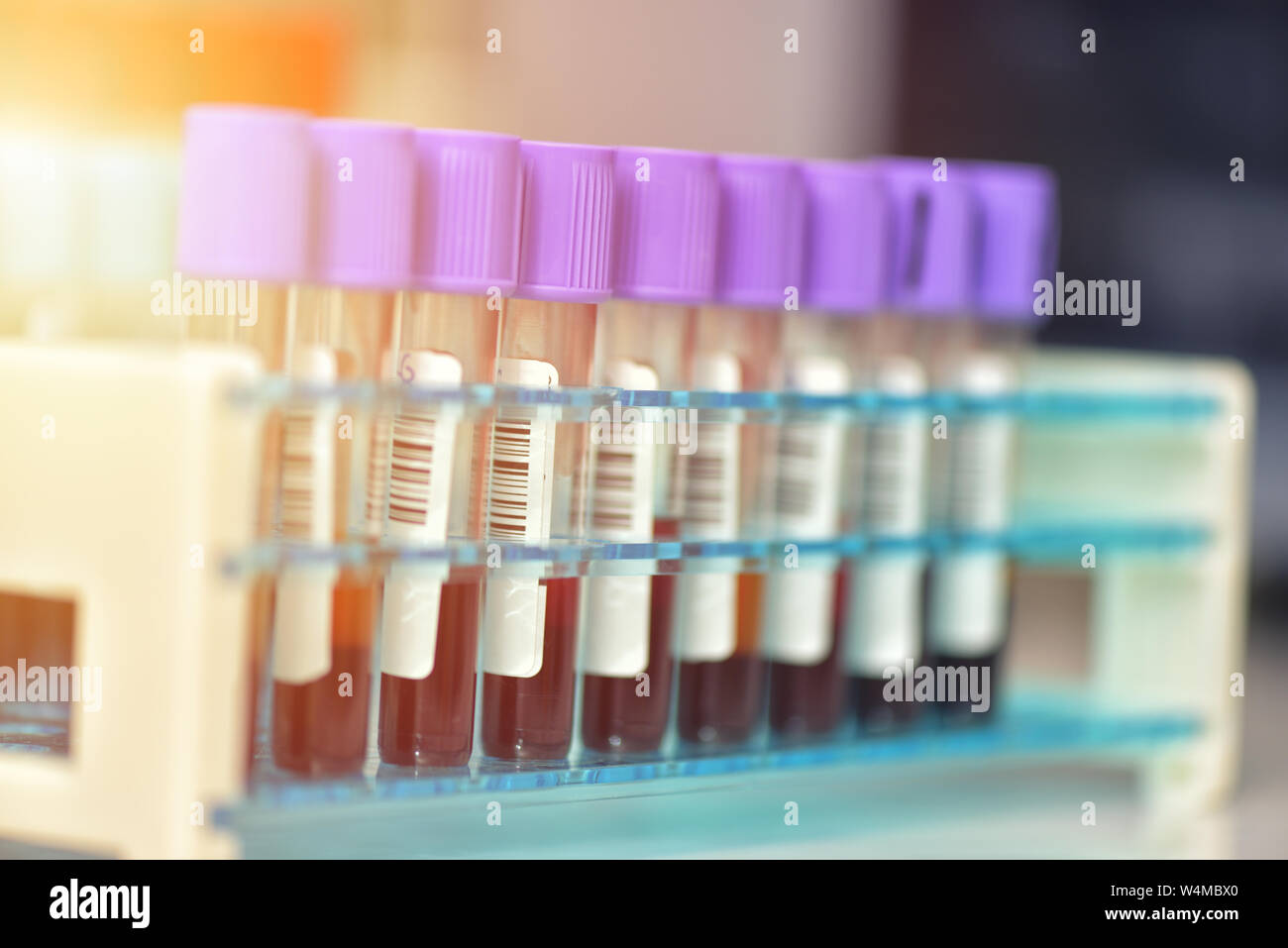 Tubes of blood sample for testing. Medical equipment Stock Photo - Alamy