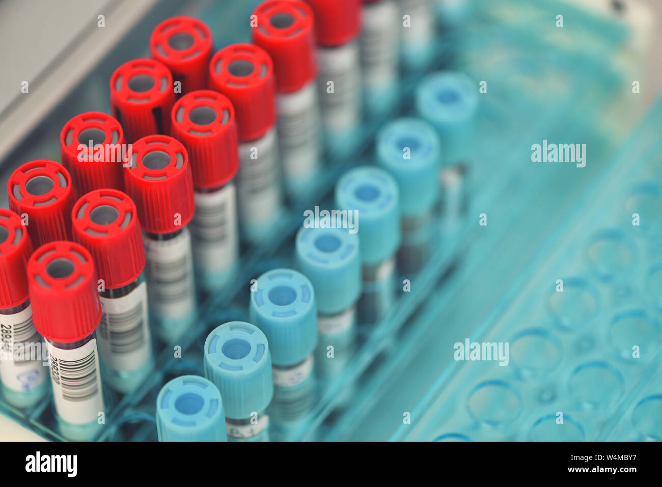 Blod test tubes hi-res stock photography and images - Alamy