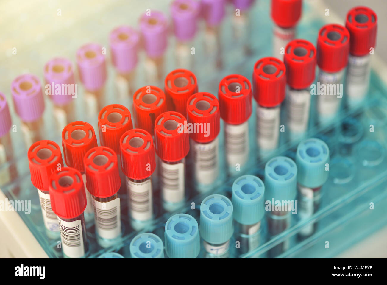 Tubes of blood sample for testing. Medical equipment Stock Photo - Alamy