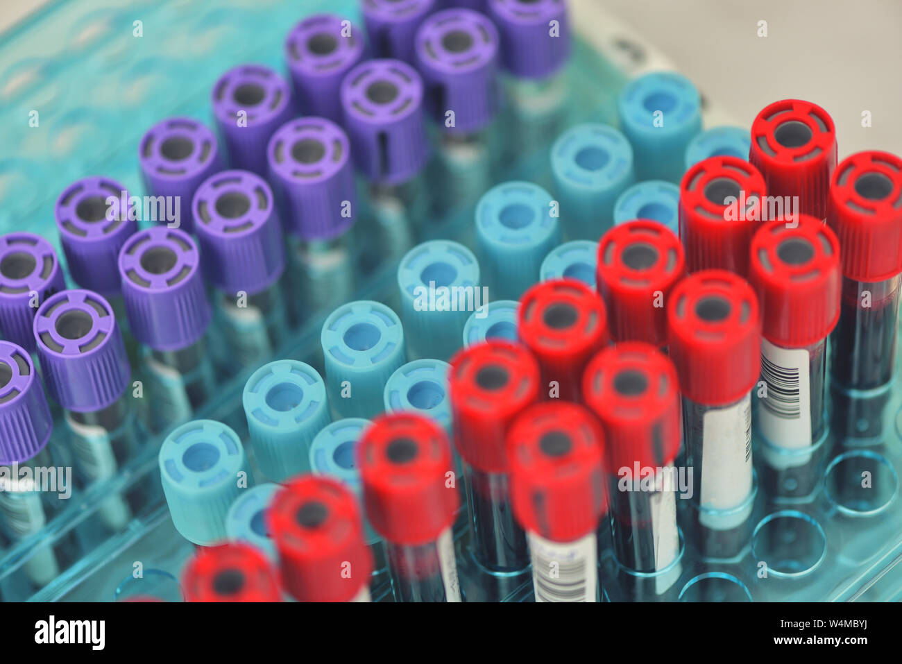 Tubes of blood sample for testing. Medical equipment Stock Photo - Alamy