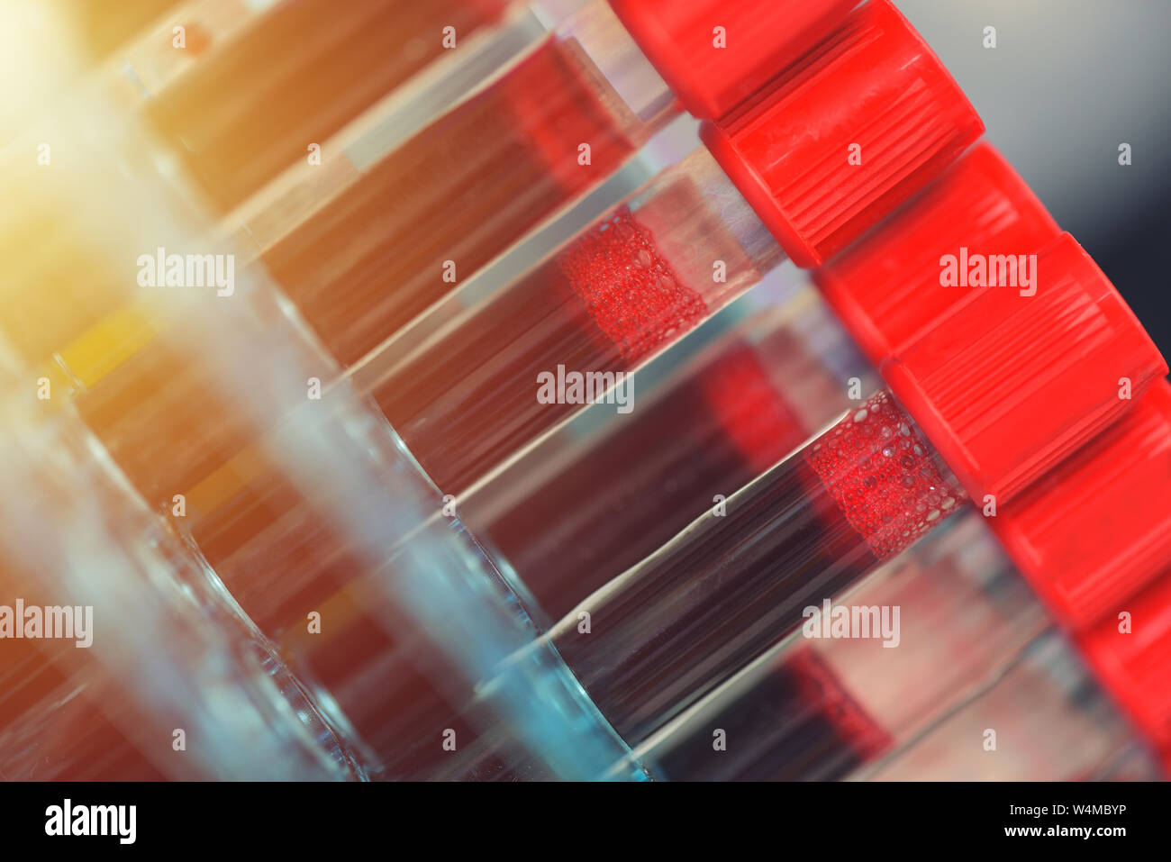 Tubes of blood sample for testing. Medical equipment Stock Photo - Alamy