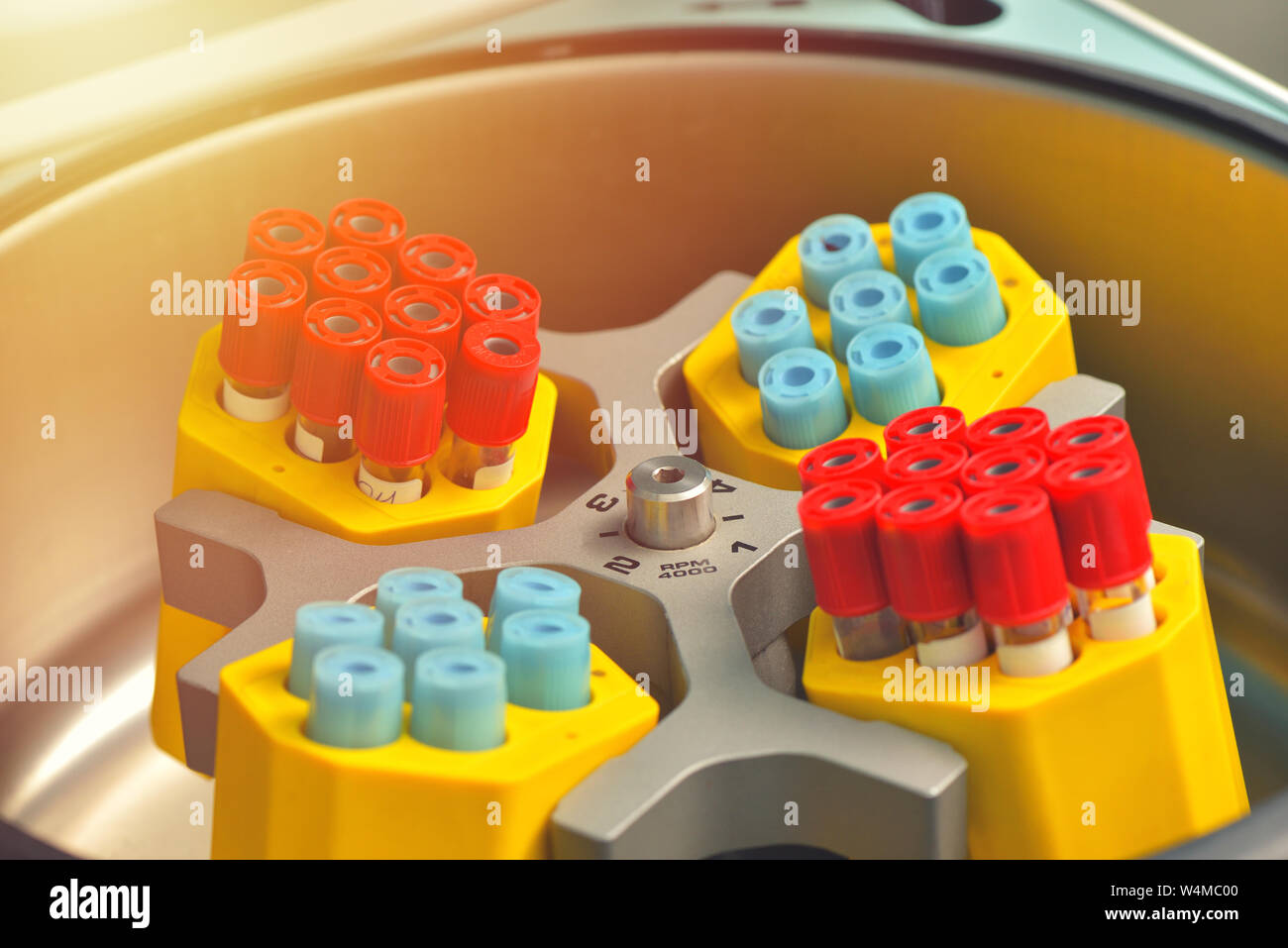 Tubes of blood sample for testing in a spin. Medical equipment Stock ...