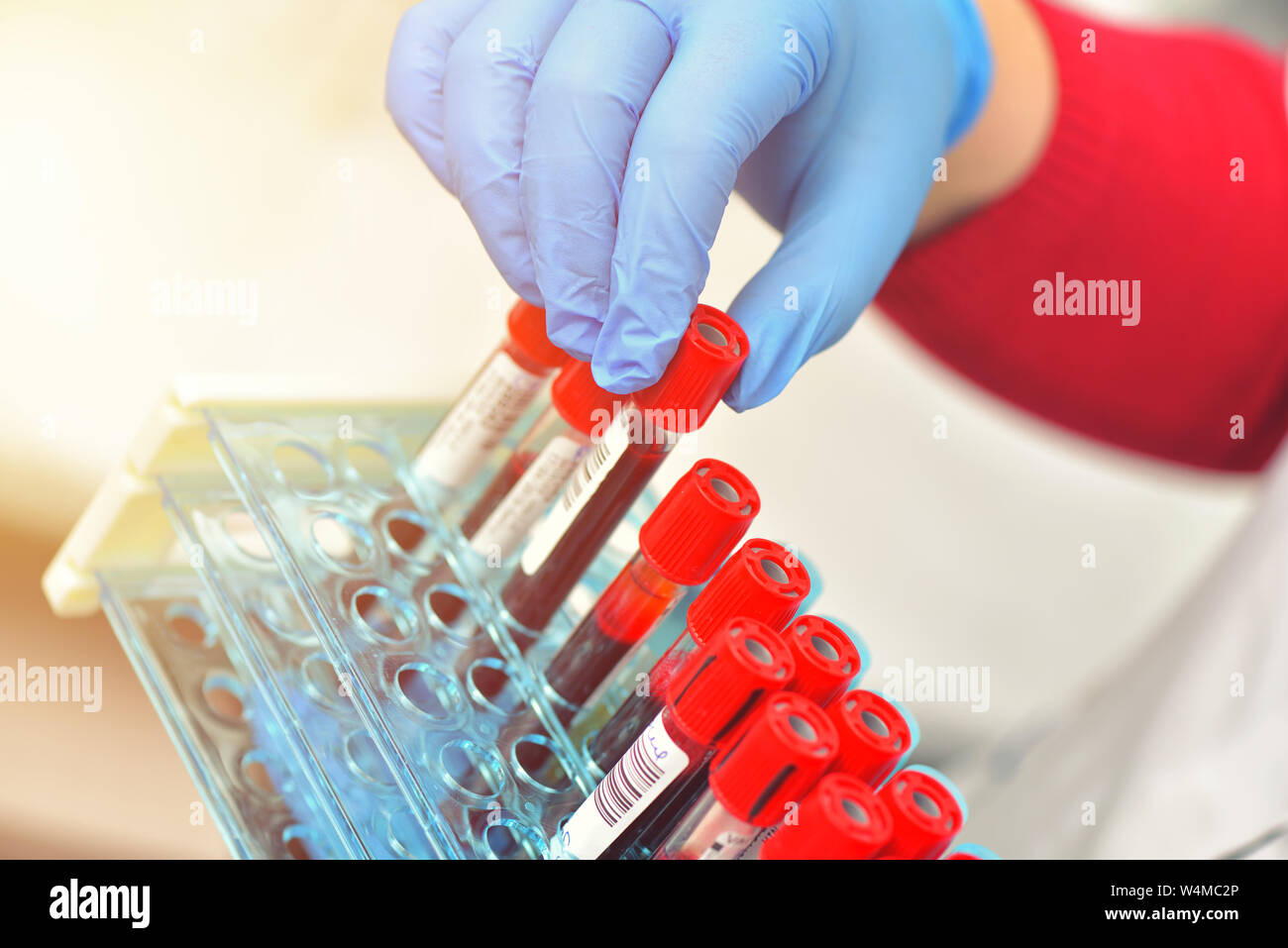 Tubes of blood sample for testing. Medical equipment Stock Photo - Alamy