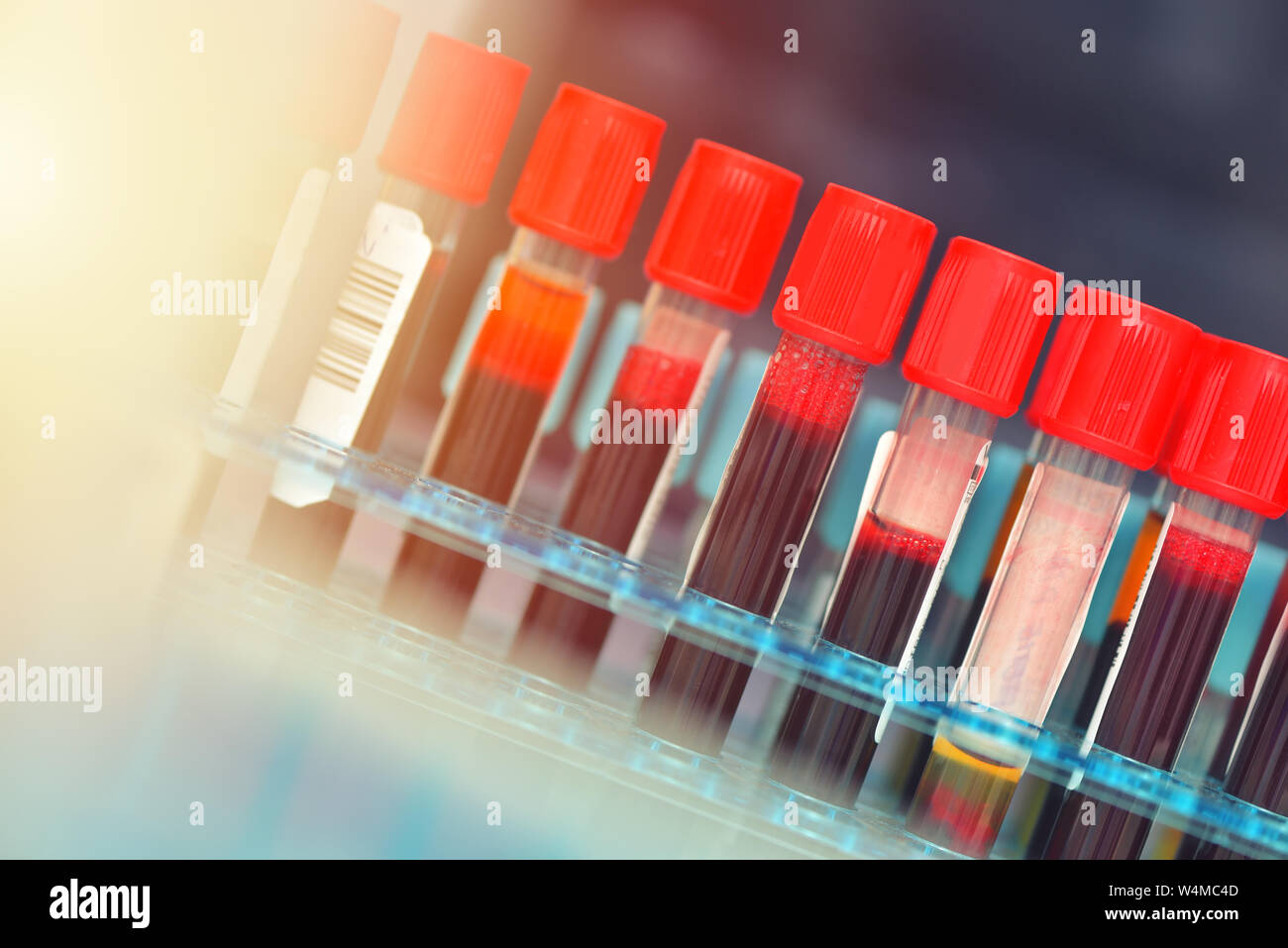 Tubes of blood sample for testing. Medical equipment Stock Photo - Alamy