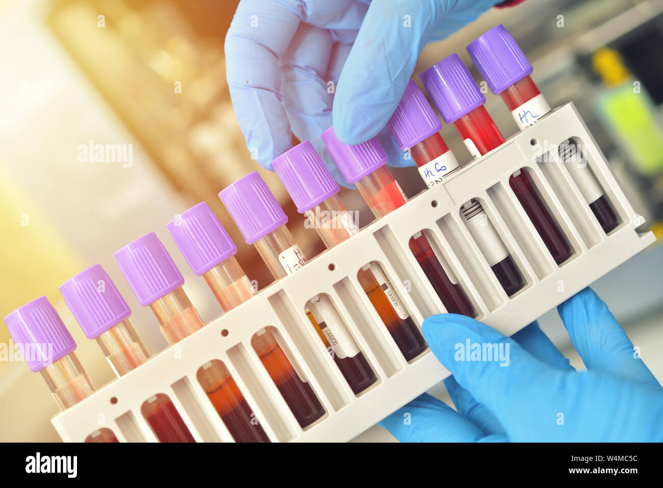 Blod test tubes hi-res stock photography and images - Alamy