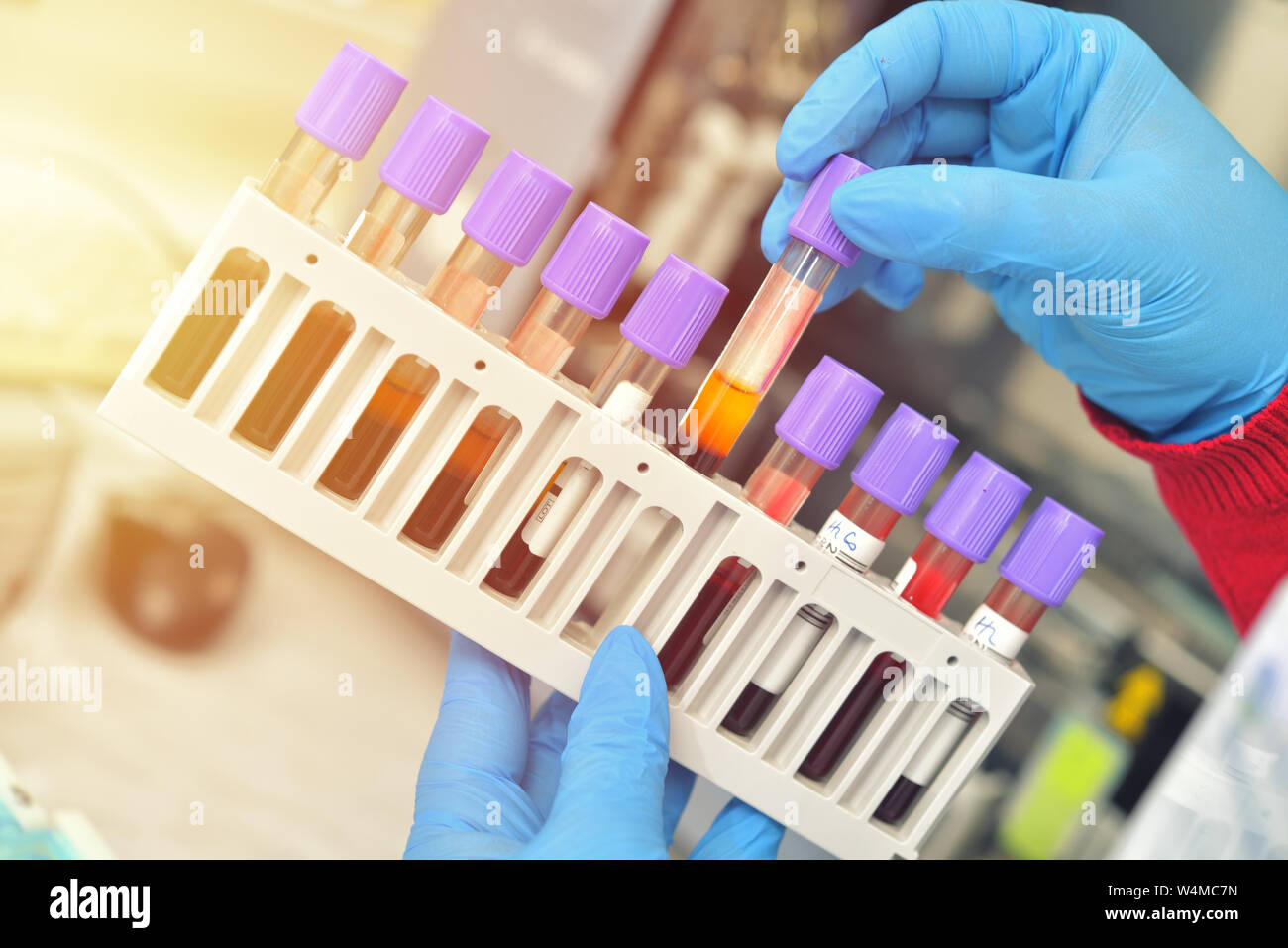 Tubes of blood sample for testing. Medical equipment Stock Photo - Alamy