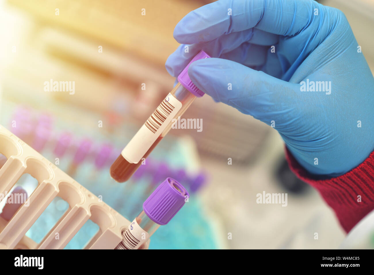 Tubes of blood sample for testing. Medical equipment Stock Photo - Alamy