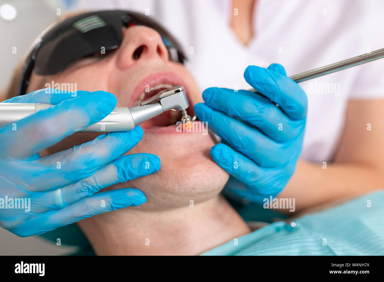 Pulpitis hi-res stock photography and images - Alamy