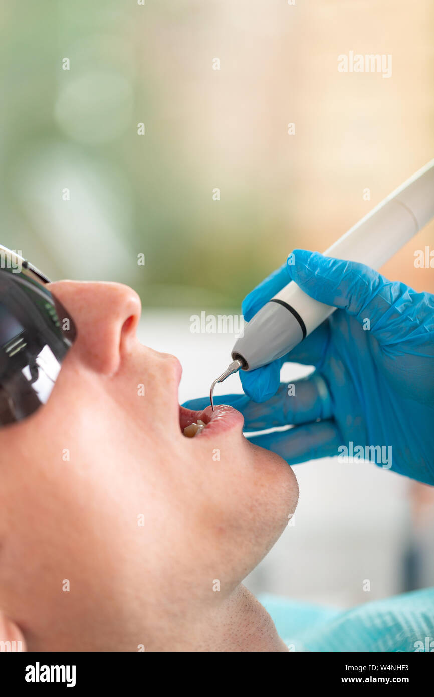 Ultrasonic teeth cleaning, close-up. Removal of tartar, plaque ...