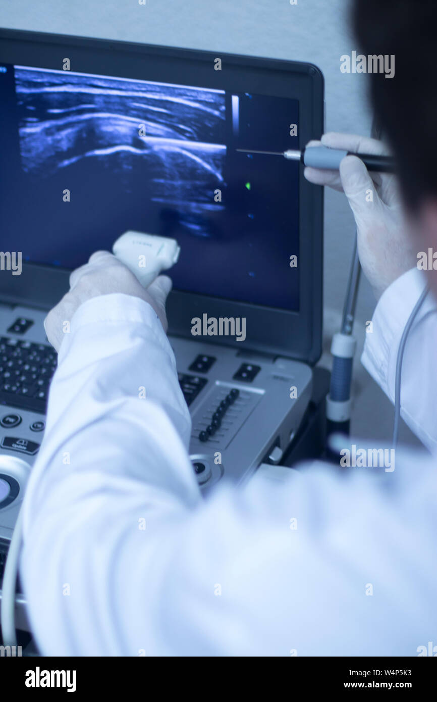 EPI Intratissue Percutaneous Electrolysis dry needling ultrasound ...