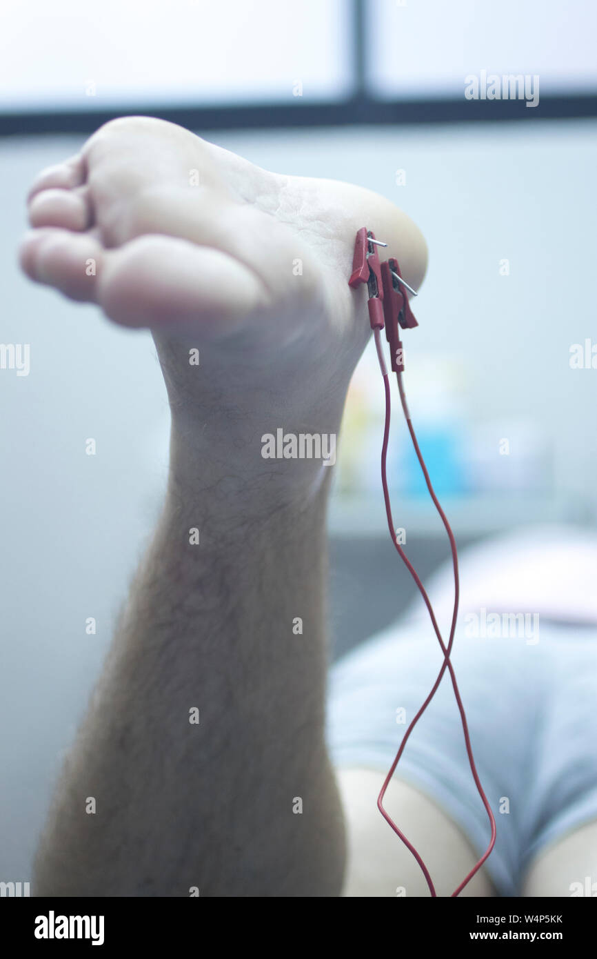 Percutaneous electrolysis therapy hi-res stock photography and images - Alamy