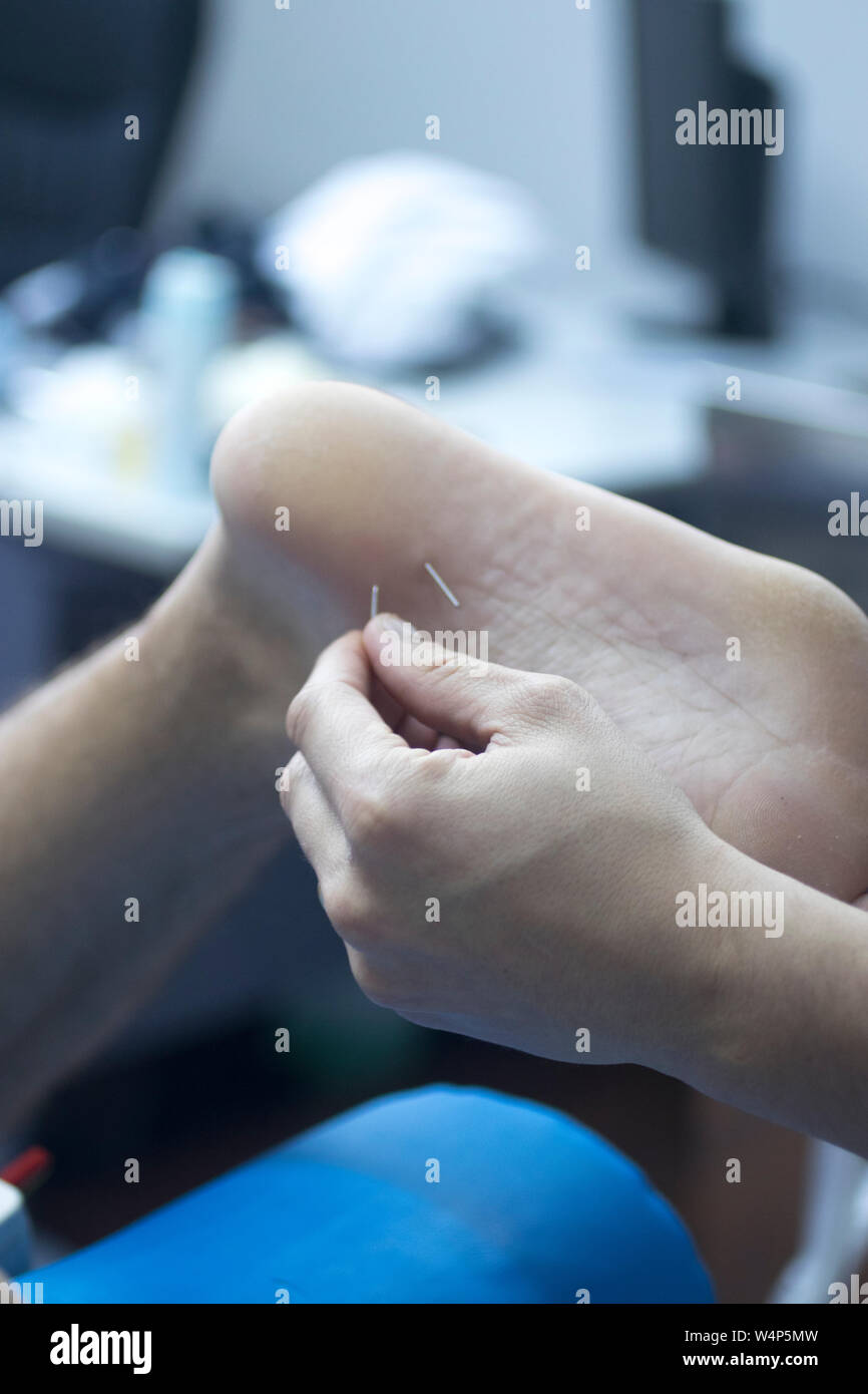 Intratissue percutaneous electrolysis hi-res stock photography and images - Alamy