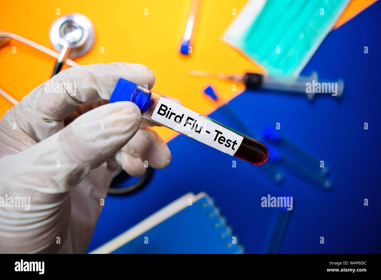 Bird Flu - Test with blood sample. Top view isolated on color ...