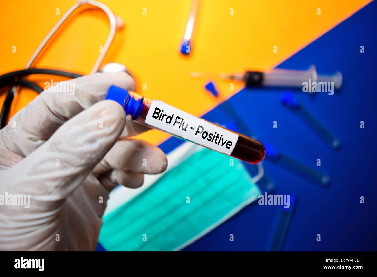 Bird Flu - Positive with blood sample. Top view isolated on color ...