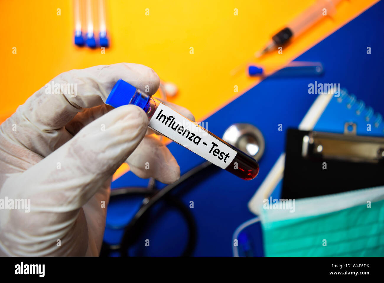 Influenza - Test with blood sample. Top view isolated on color ...