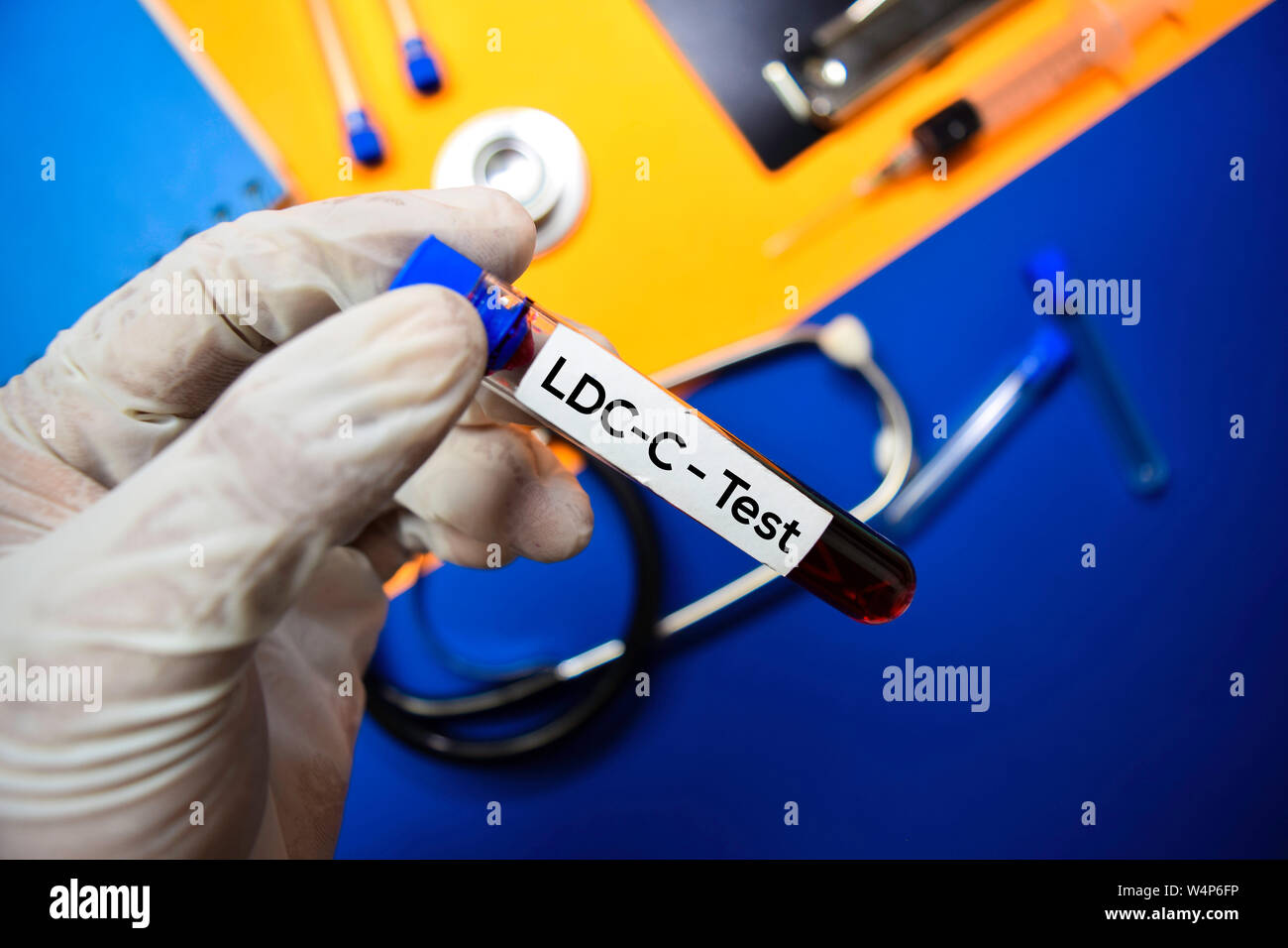 LDC-C Test with blood sample. Top view isolated on color background ...