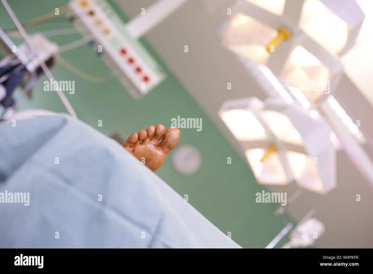 Foot of patient on surgery operation table Stock Photo - Alamy