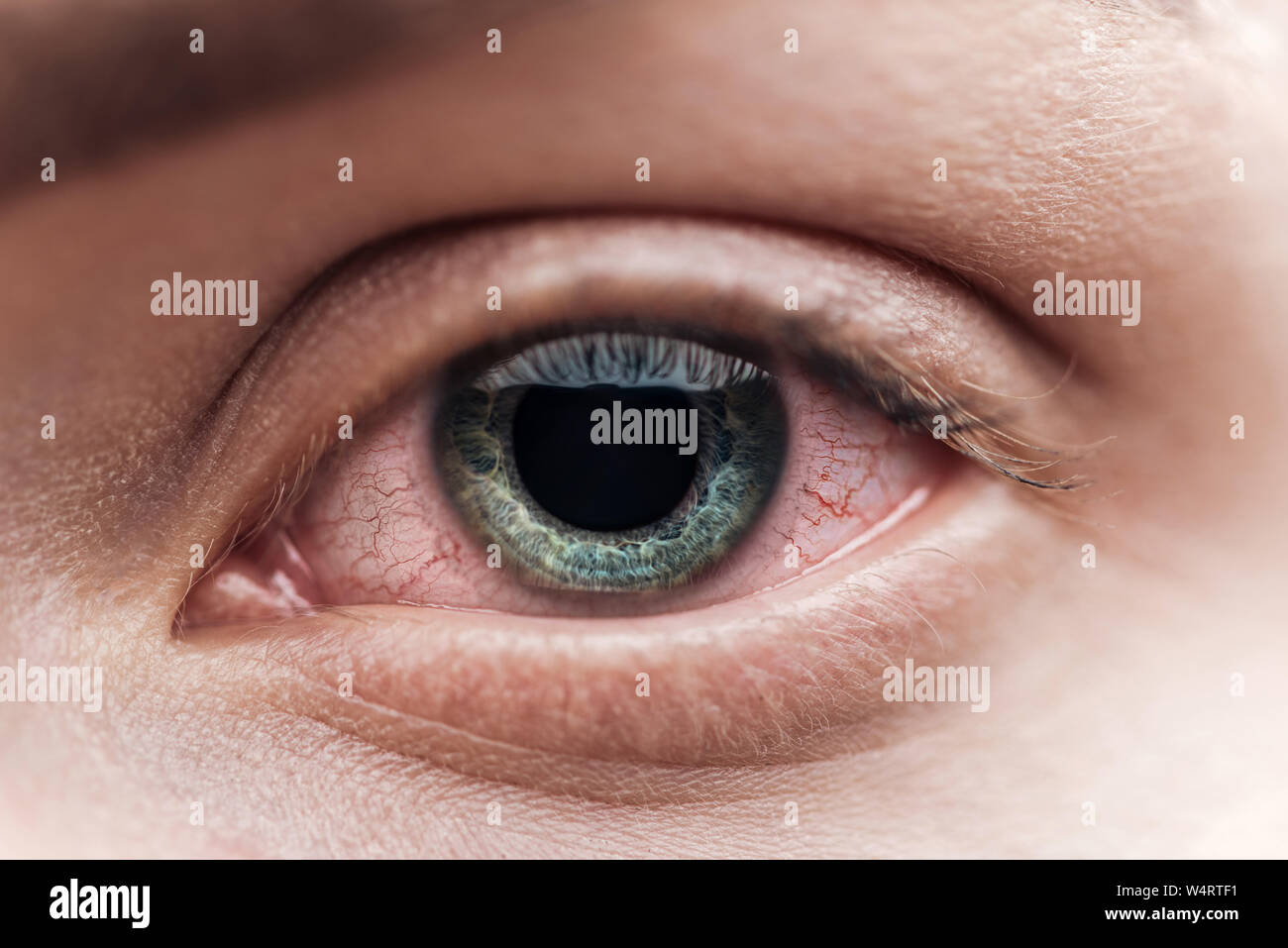 close up view of human eye with red capillaries Stock Photo - Alamy