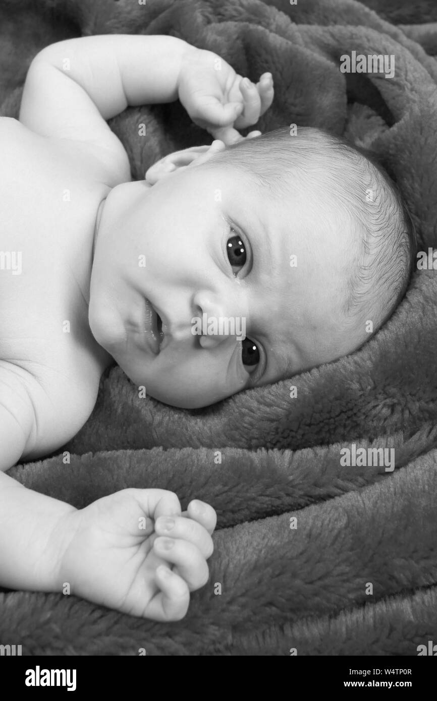 Syndrome baby hi-res stock photography and images - Alamy