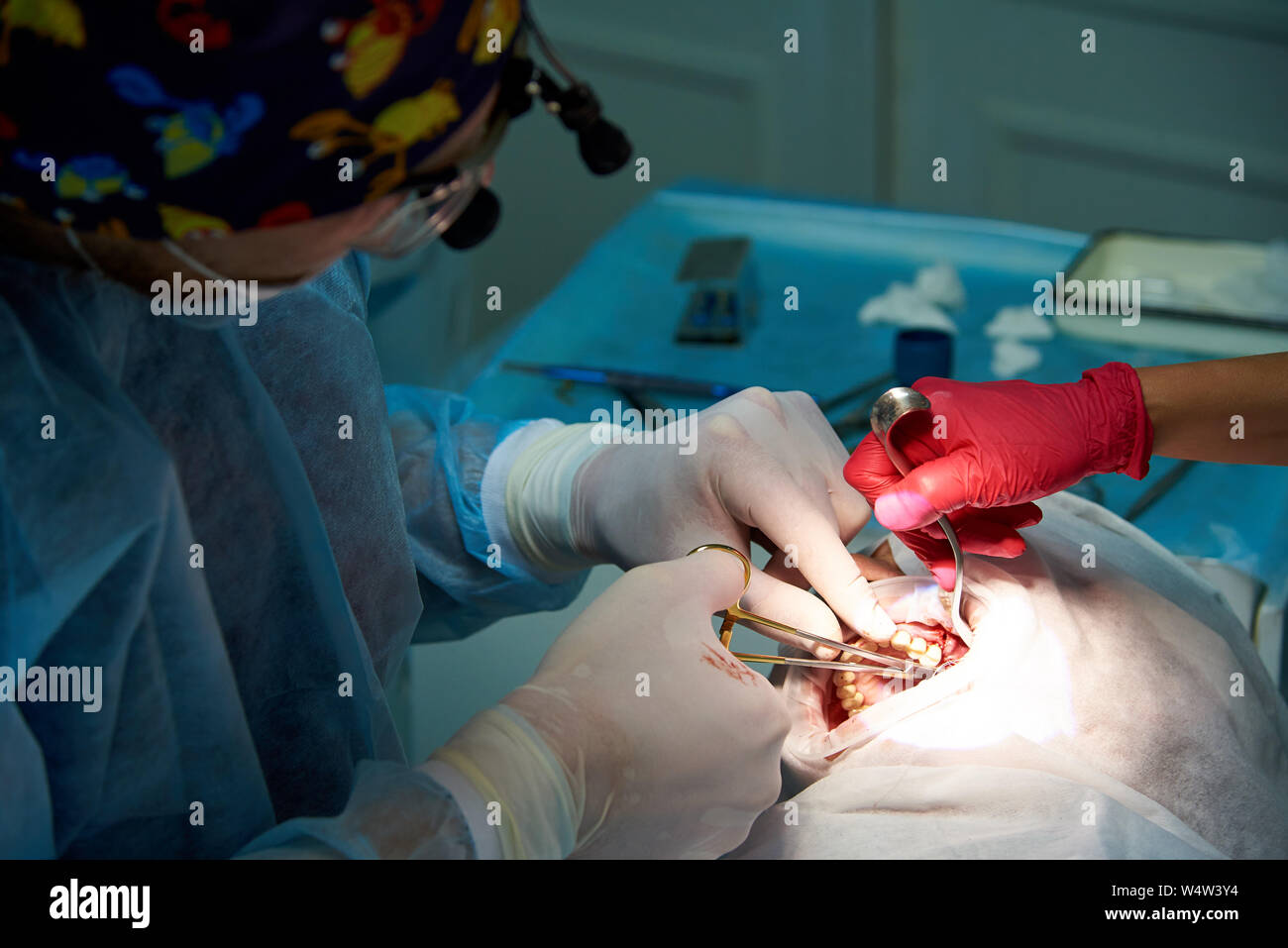 Surgery in the dental clinic.Doctor sews up a wound in the patient's ...