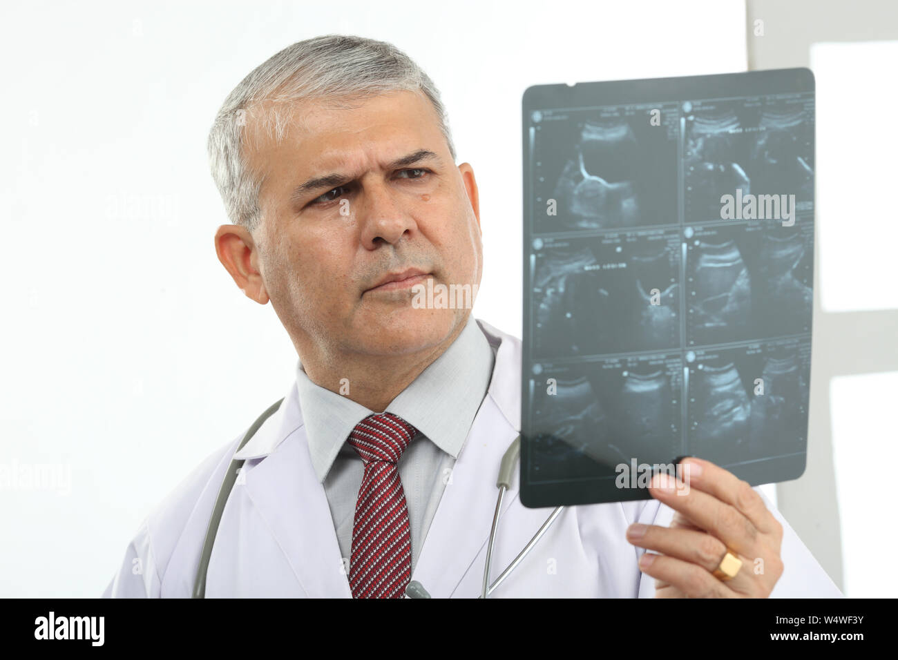 Indian male doctor examining an x-ray report Stock Photo - Alamy