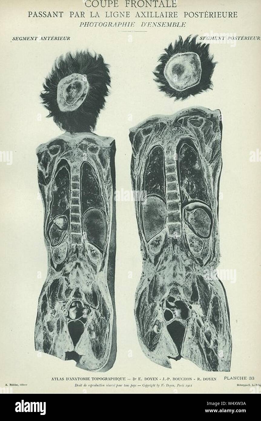 Axillaire hi-res stock photography and images - Alamy