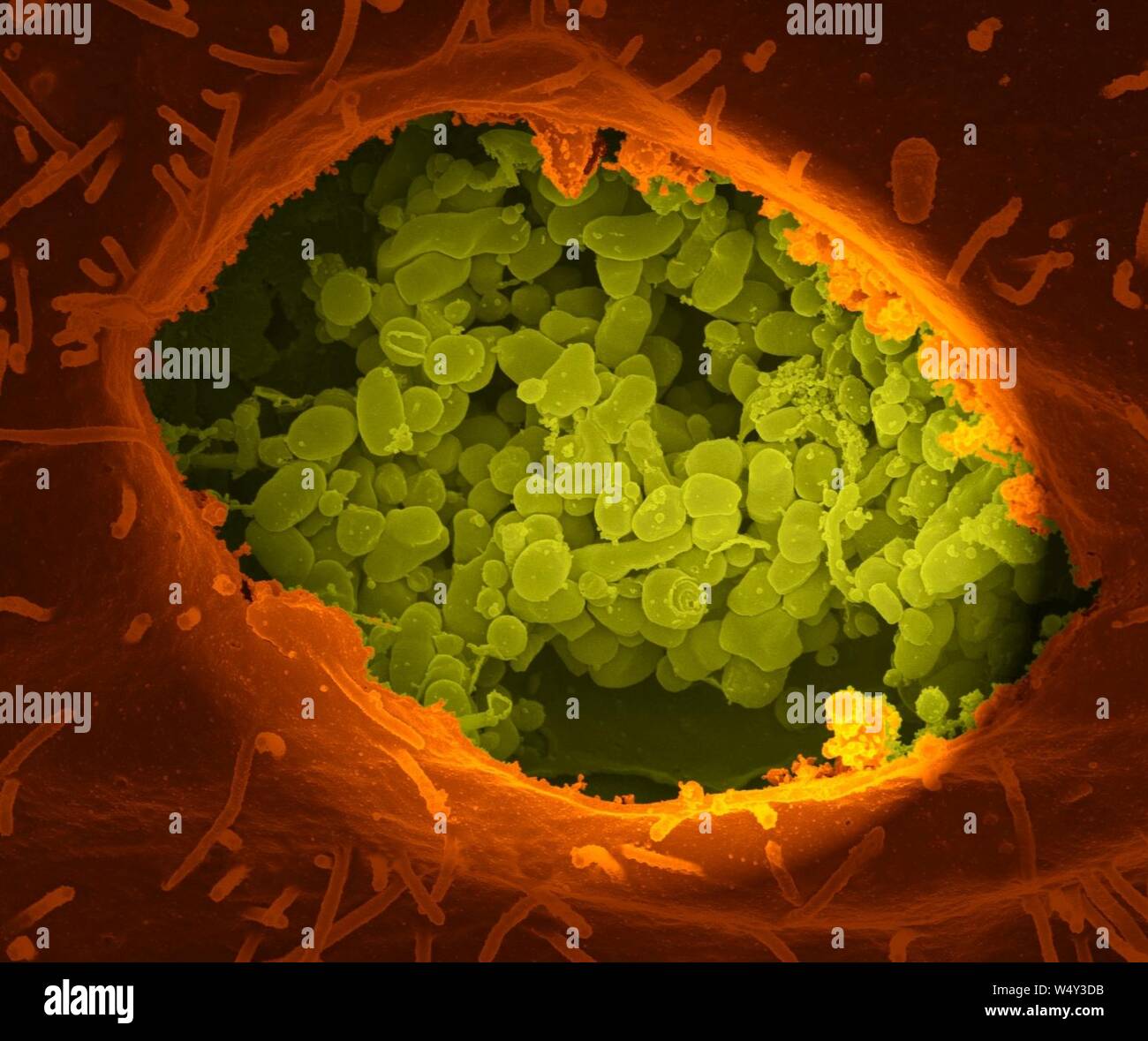Coxiella burnetii, the bacteria that causes Q Fever Stock Photo - Alamy