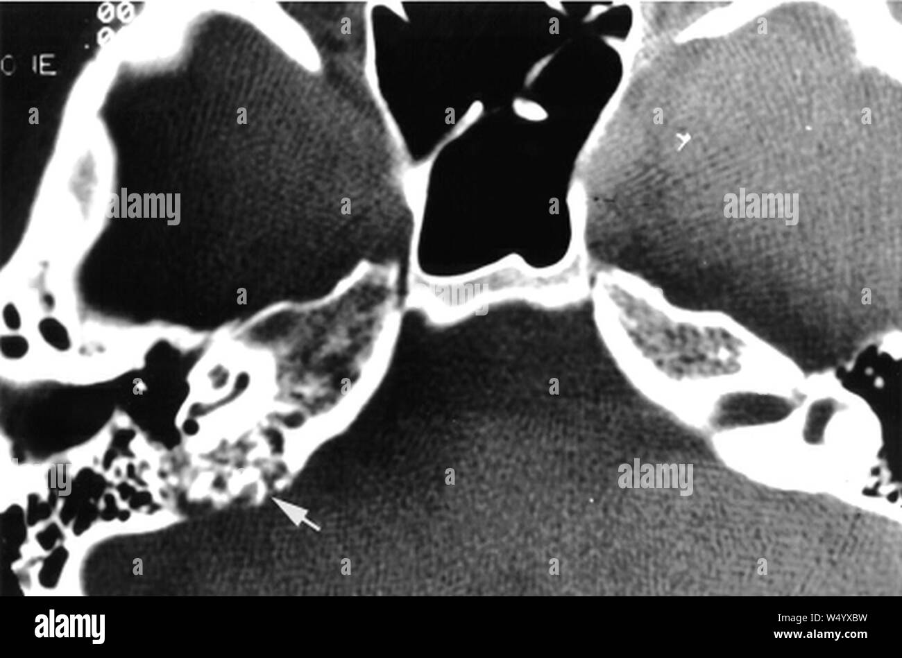 Ct image through hi-res stock photography and images - Alamy