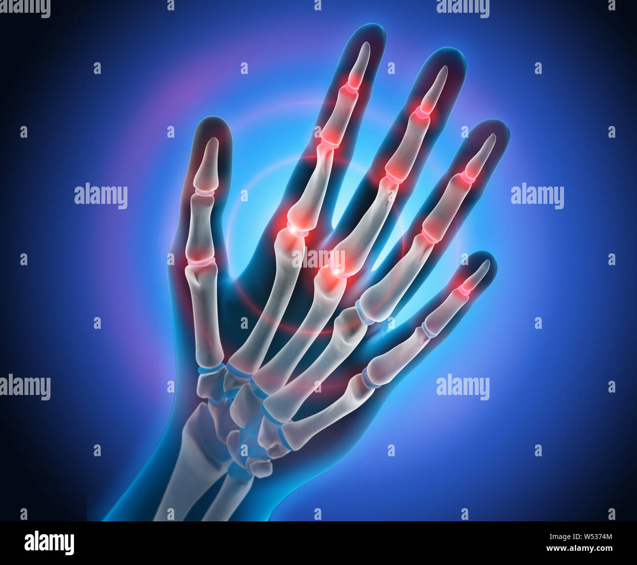 Rheumatology hi-res stock photography and images - Alamy