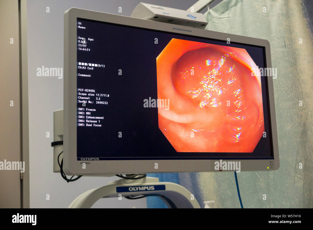 Display screen during the bowel scope screening test (flexible ...