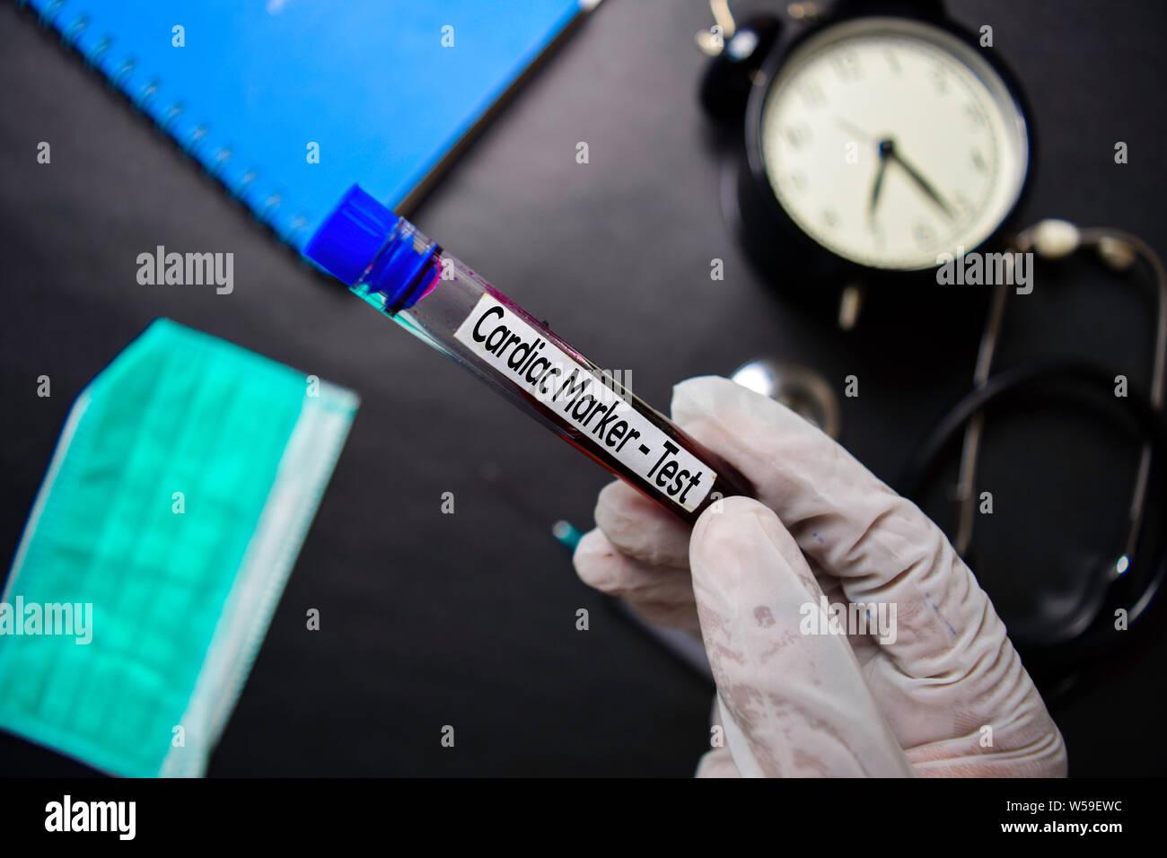 Cardiac Marker - Test with blood sample. Top view isolated on black ...