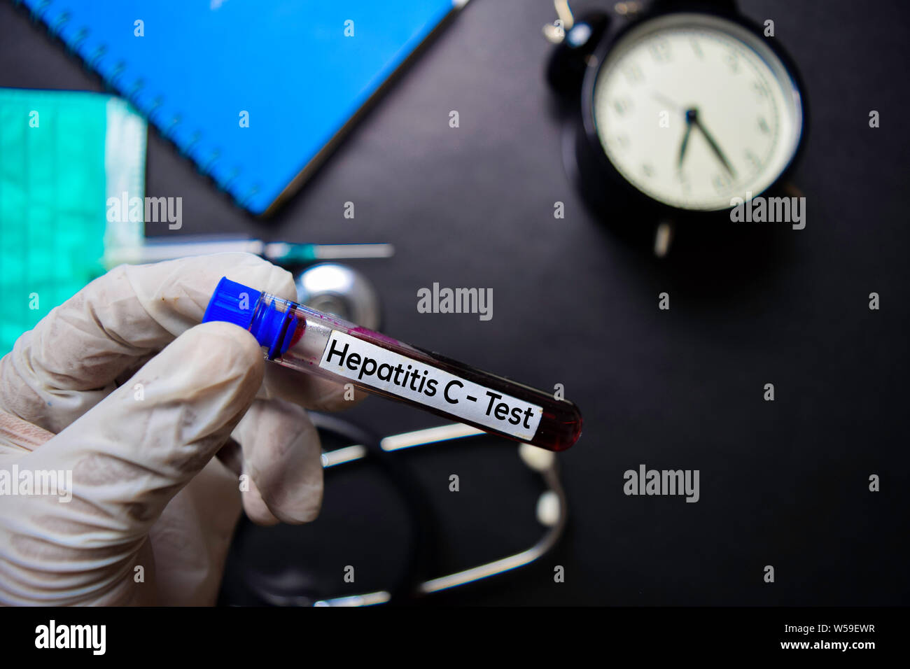Hepatitis C - Test with blood sample. Top view isolated on black ...