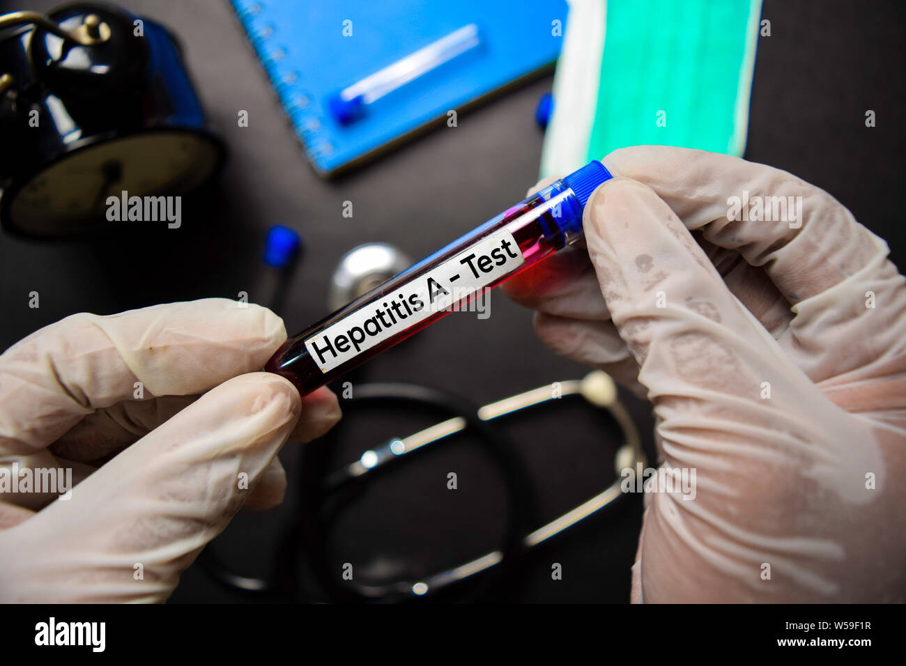 Hepatitis A - Test with blood sample. Top view isolated on black ...