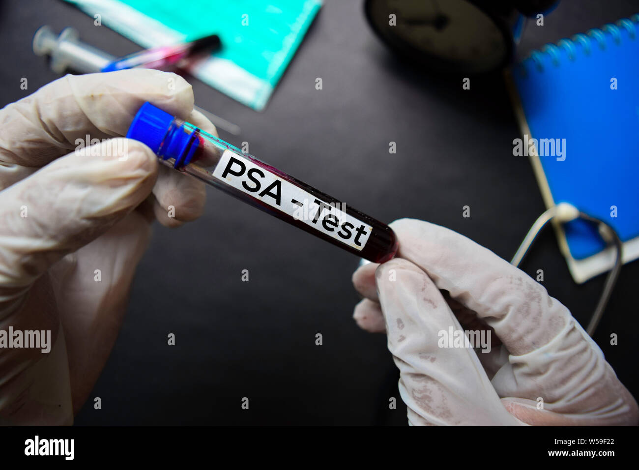 PSA - Test with blood sample. Top view isolated on black background ...