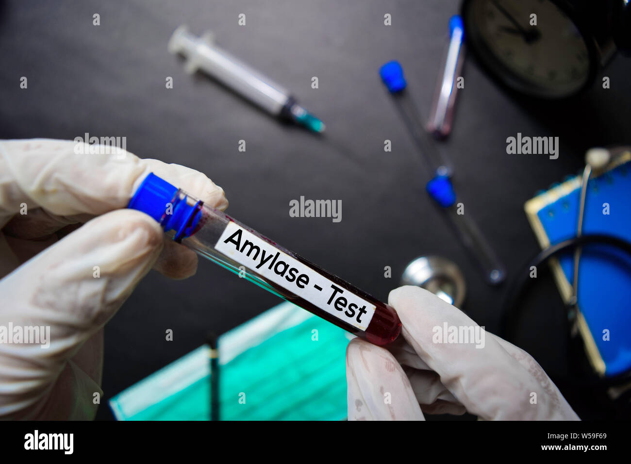 Amylase - Test with blood sample. Top view isolated on black background ...