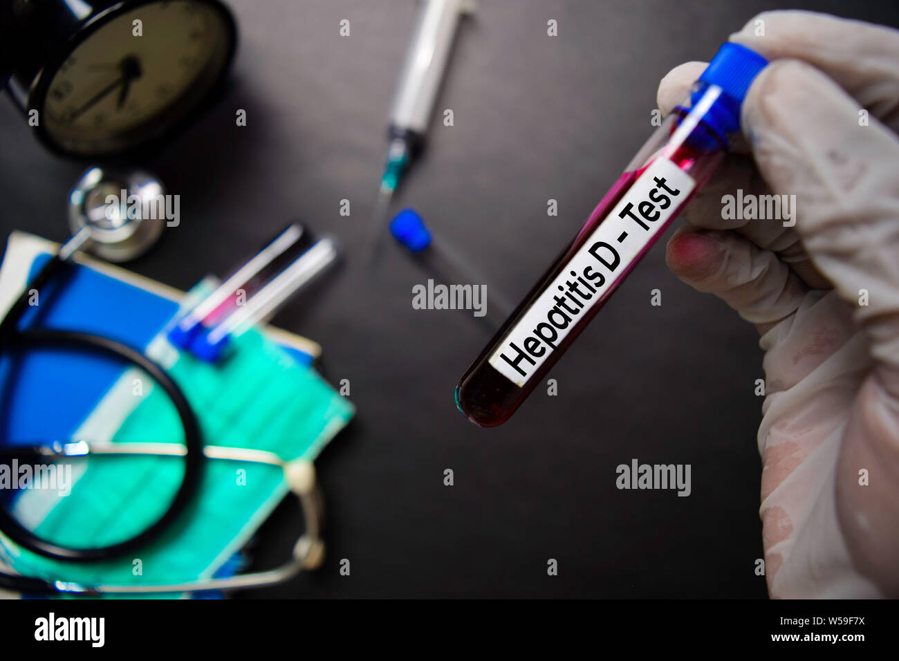 Hepatitis D - Test with blood sample. Top view isolated on black ...