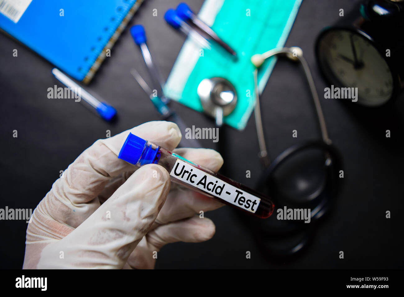 Uric Acid - Test with blood sample. Top view isolated on black ...
