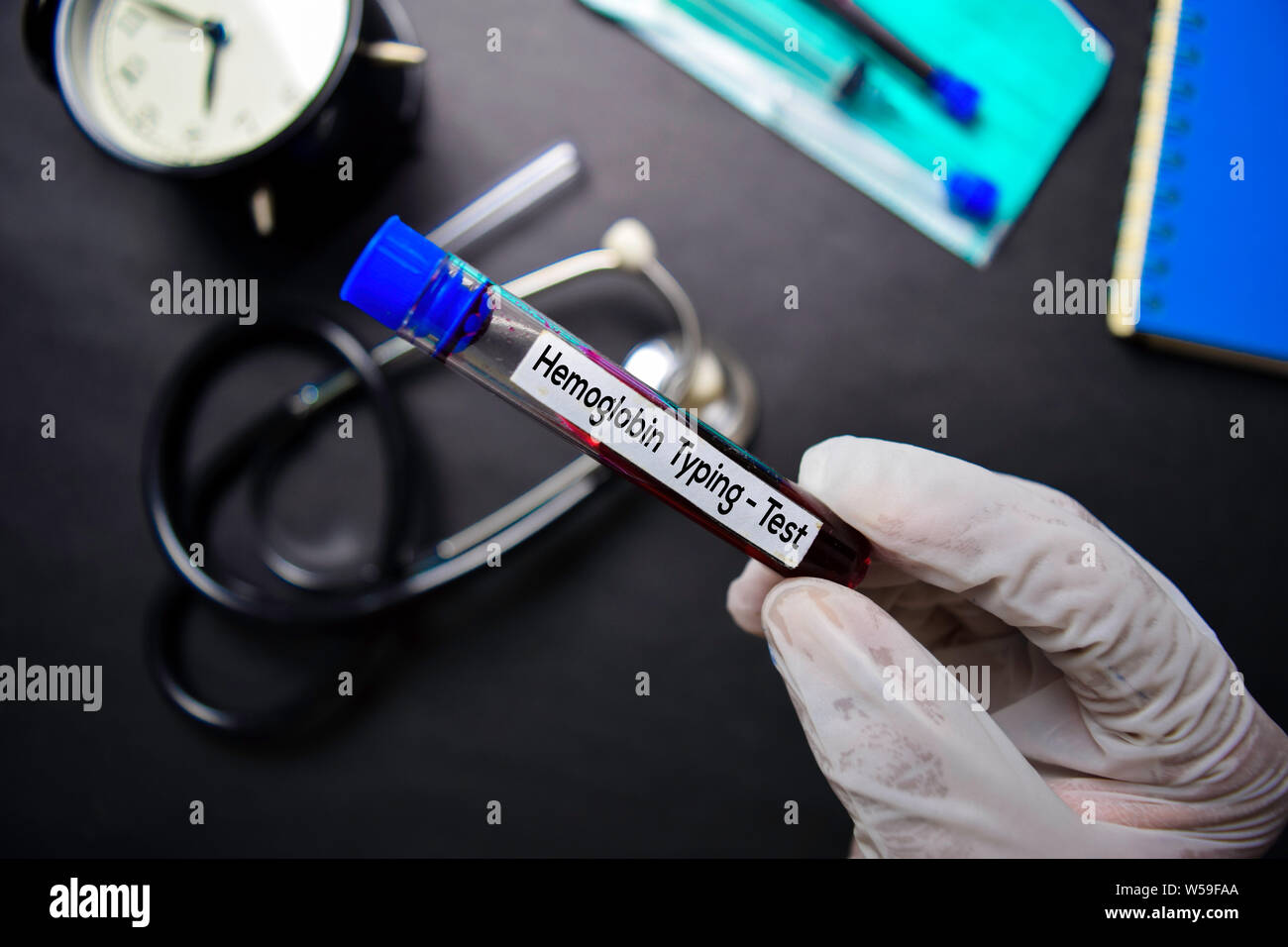 Hermoglobin Typing - Test with blood sample. Top view isolated on black ...