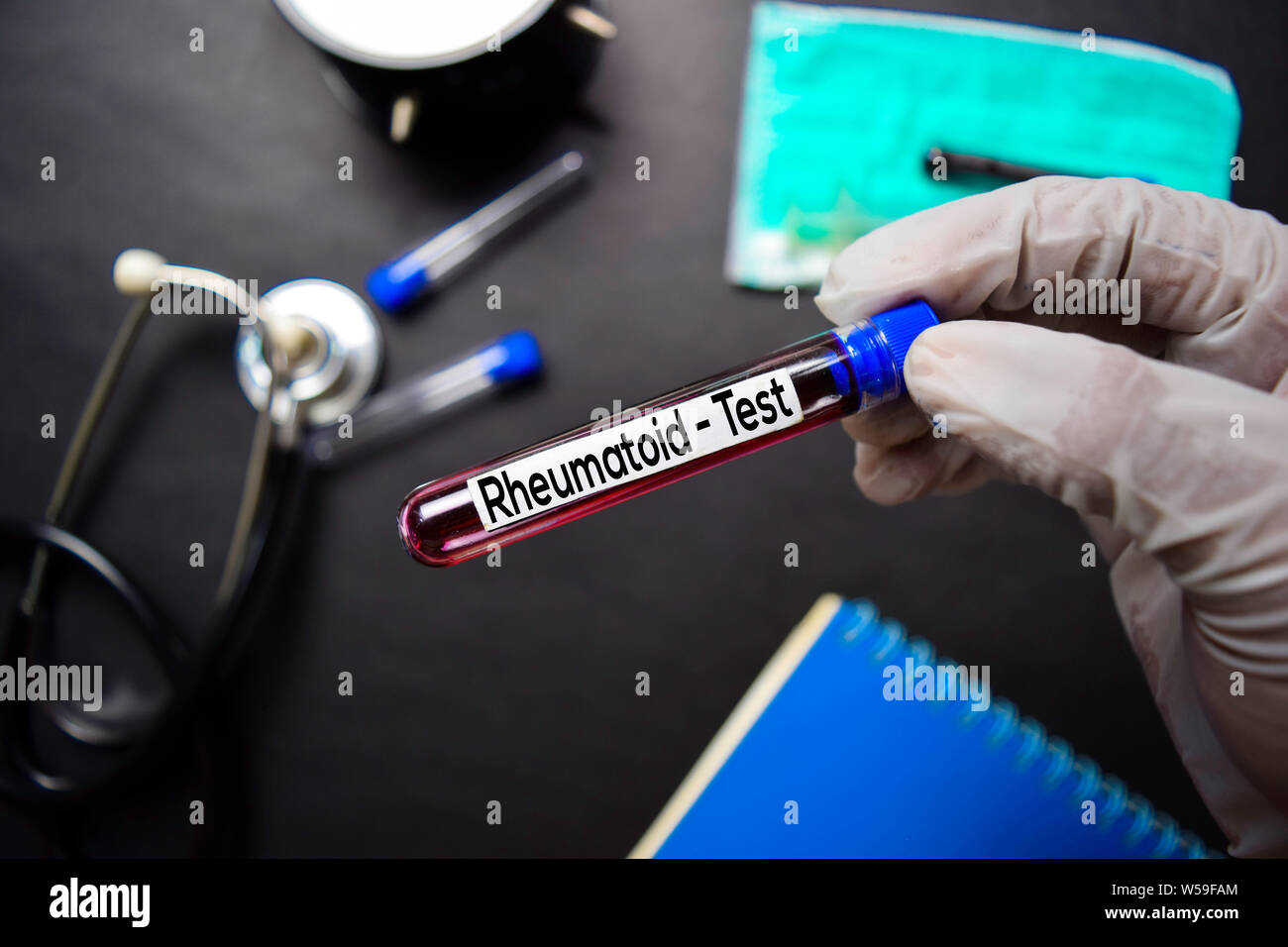 Rheumatoid - Test with blood sample. Top view isolated on black ...