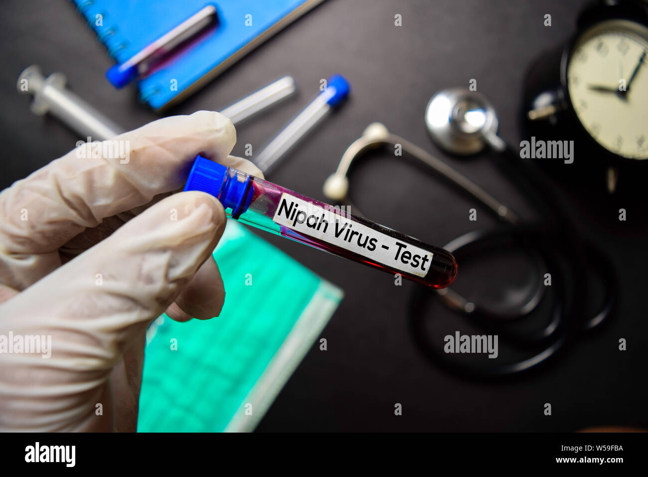 Nipah Virus - Test with blood sample. Top view isolated on black ...