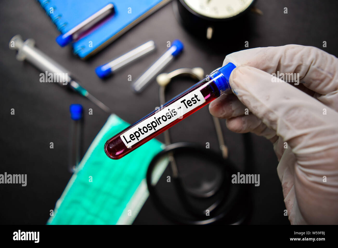 Leptospirosis - Test with blood sample. Top view isolated on black ...