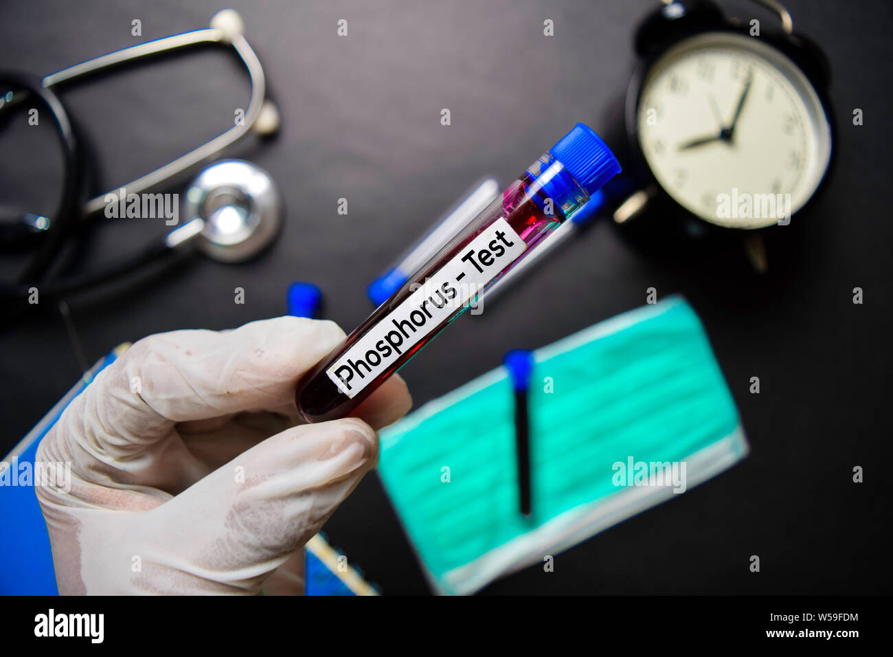 Phosphorus - Test with blood sample. Top view isolated on black ...