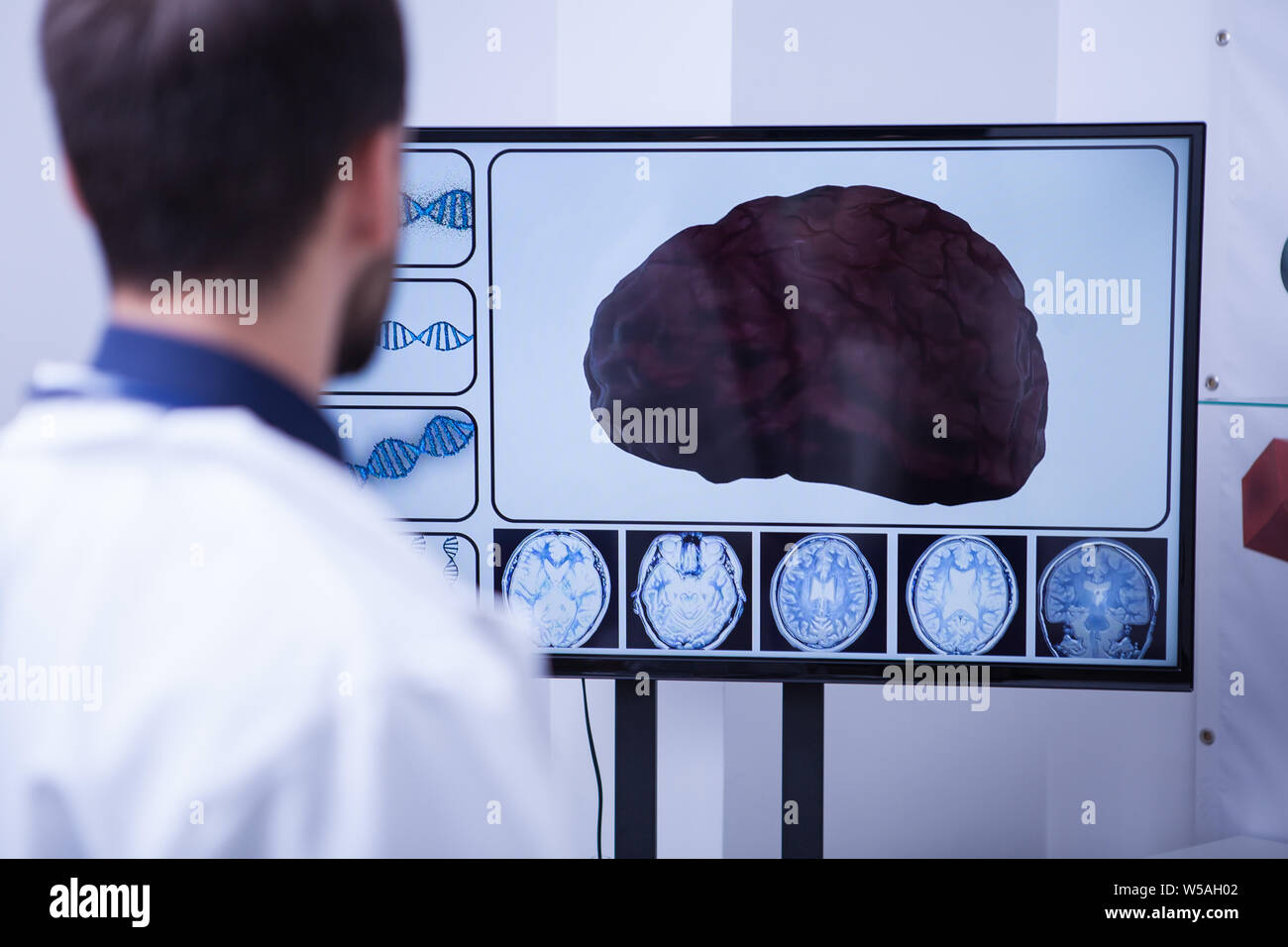Young doctor checking a brain after nerve surgery. Brain with severe ...