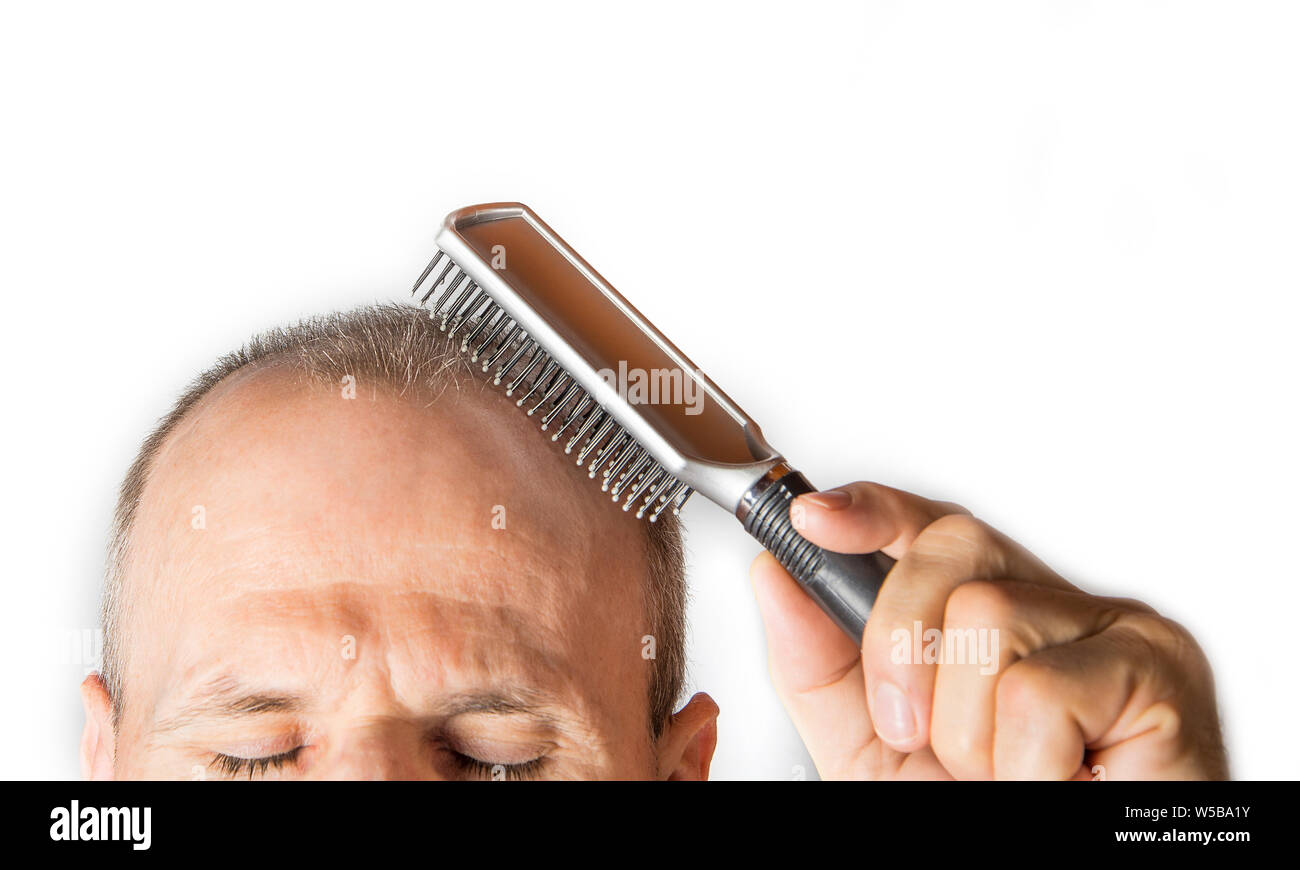 Bald man with comb. Hair Loss concept Stock Photo - Alamy