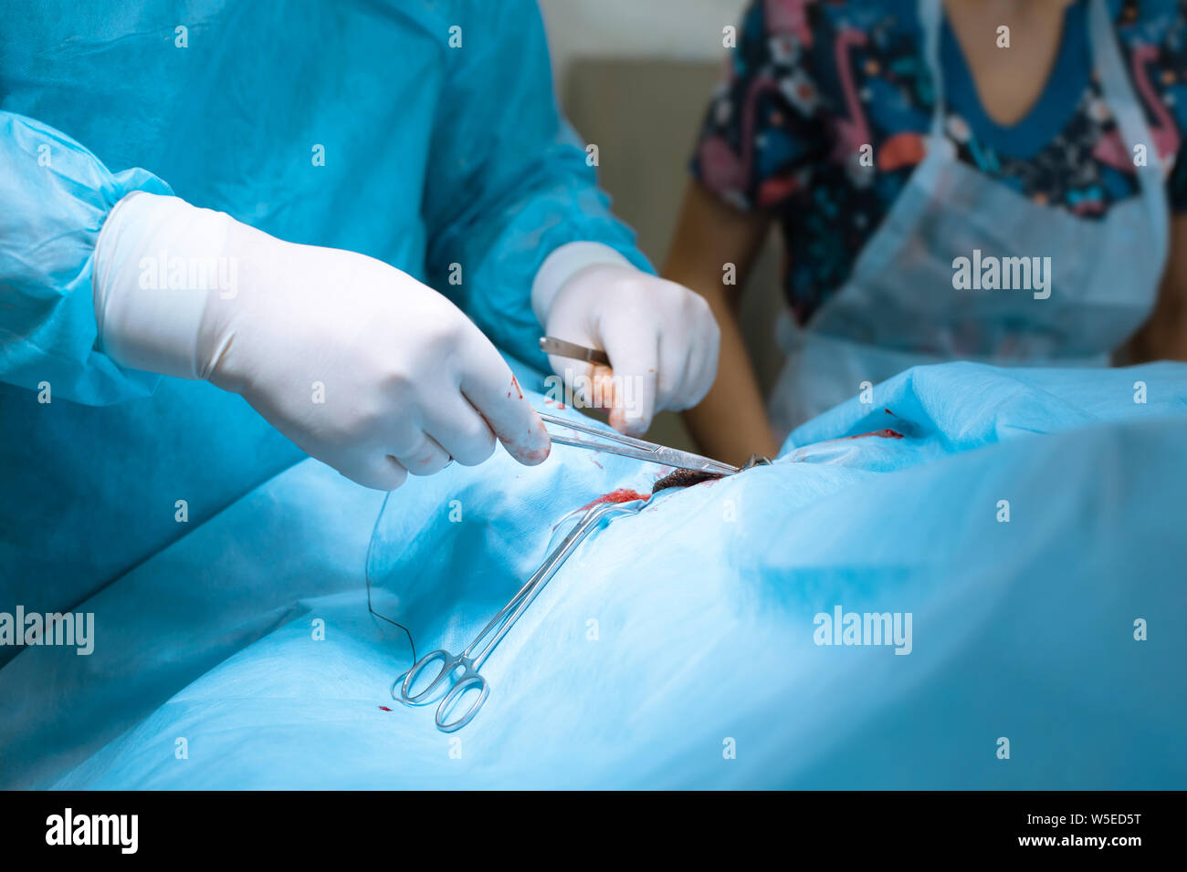 the surgeon applies a surgical clamp to stop the bleeding. Group of ...