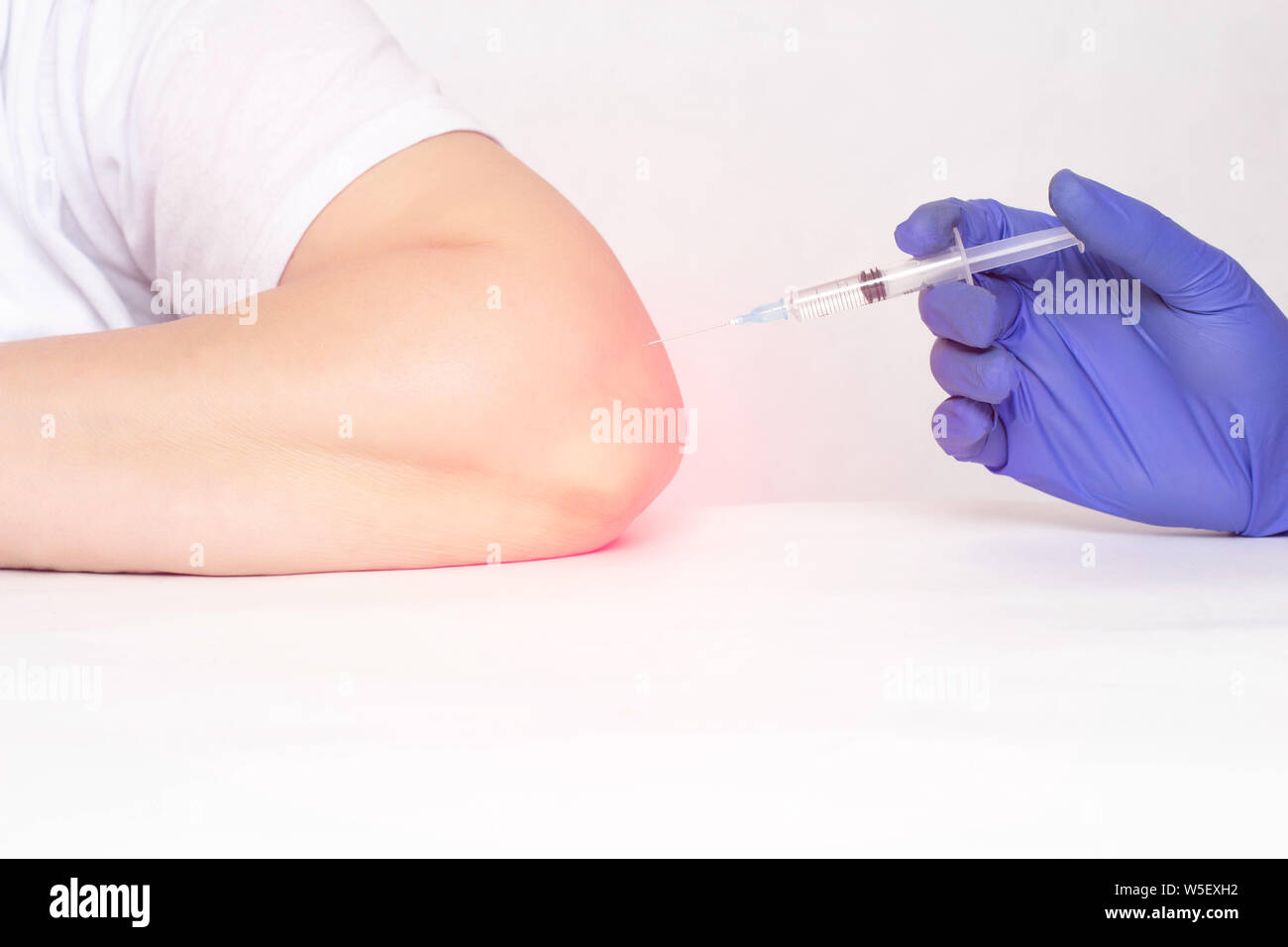 A doctor makes an injection into the elbow joint of a woman who has ...