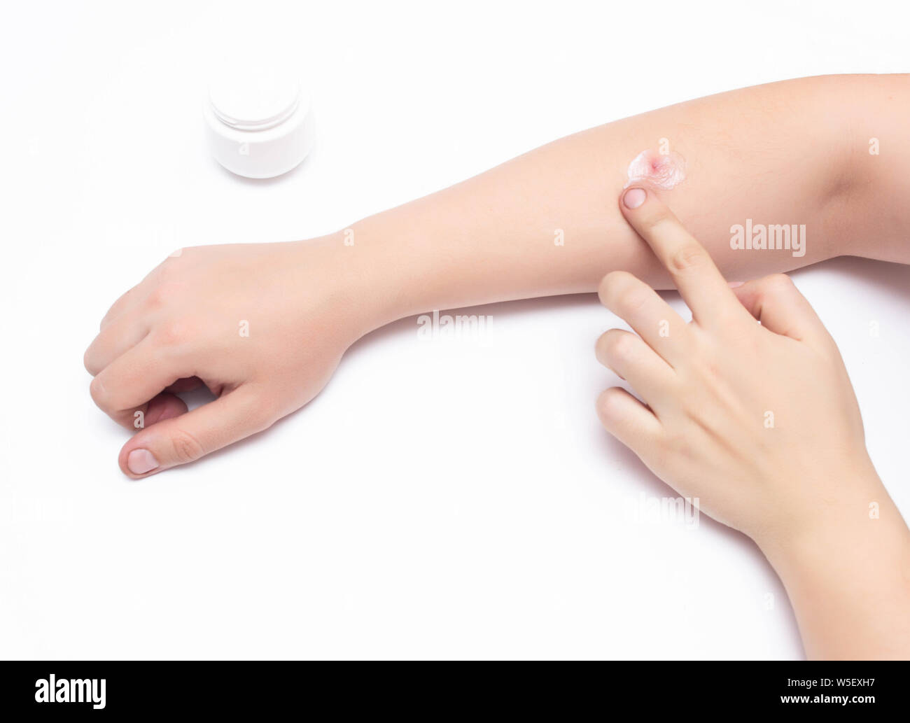 Man smears a medical hormone ointment with a gray red sore pimple on ...
