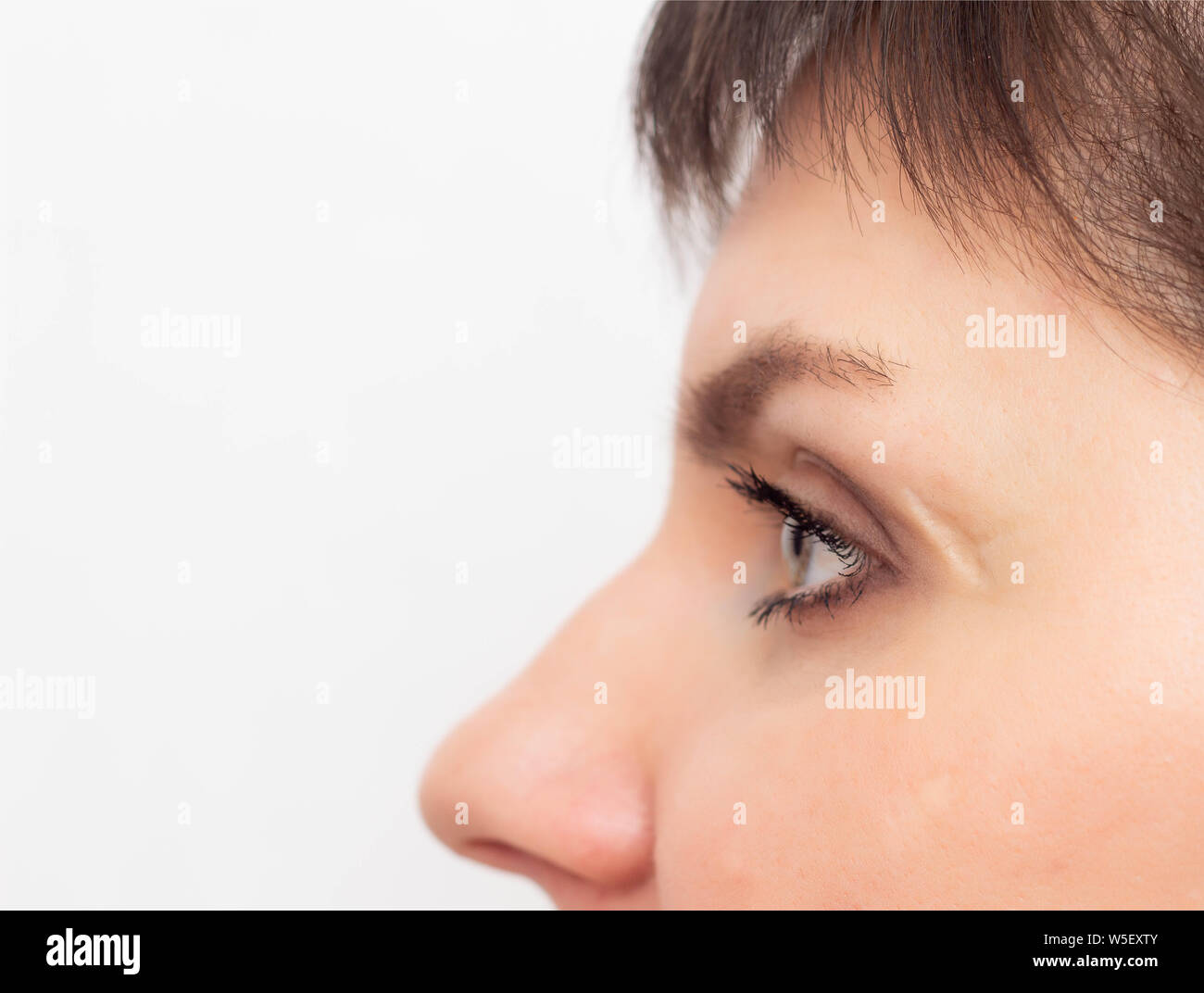 Large scar and scar on the face of a girl near the temple, methods for ...